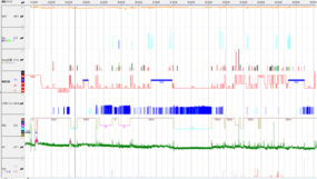 OAで呼吸イベントだけでなくPLMも改善した症例 ｜ゆみのPSGケースカンファ｜活動報告｜医療法人社団ゆみの